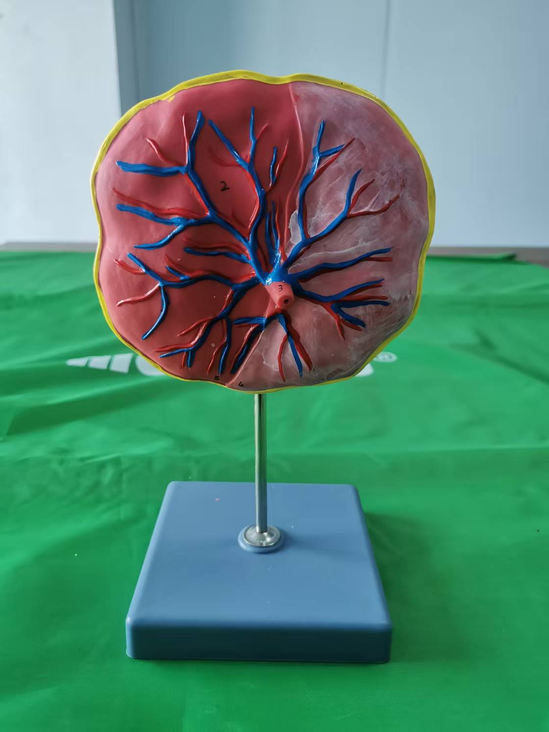 Placenta Model - Shanghai Jolly Medical Education Co., Ltd.